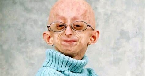 Progeria