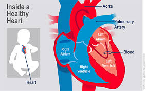 Patent Ductus Arteriosus (PDA) - How To Guide | Tips And Tricks ...