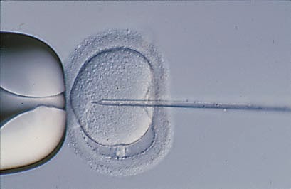 Proyecto de bebé: Mi primera ICSI