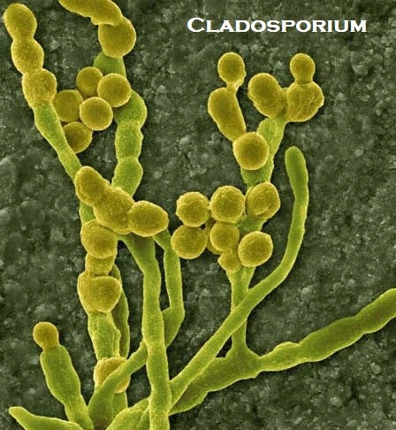 INFECTIOUS DISEASE: Fungal infections