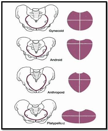 Pengetahuan Umum Kebidanan: PEMERIKSAAN PANGGUL