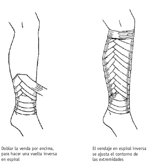 PROTOCOLO DE PRIMEROS AUXILIOS PARA APLICACIÓN DE VENDAJES