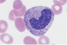 [Haematology] Normal Cells of the Blood and Hematopoietic Organs | Free ...