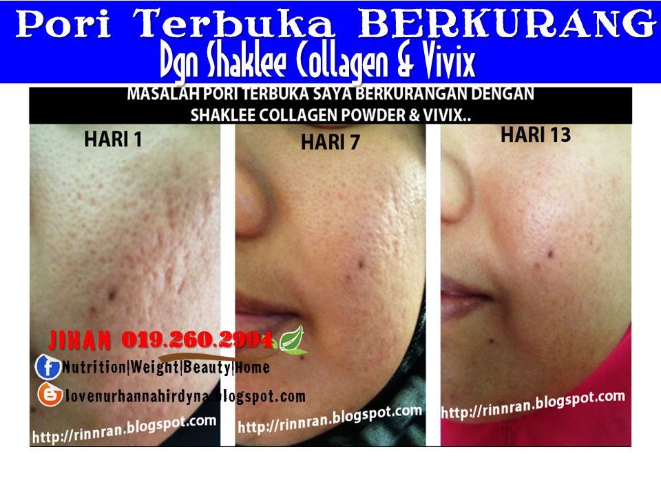 Pori-pori terbuka berkurang dgn Shaklee Collagen & Vivix | Little ...