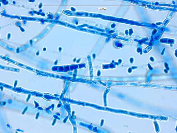 Fun With Microbiology (What's Buggin' You?): Trichophyton tonsurans