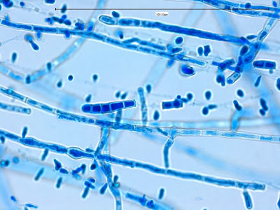 Fun With Microbiology (What's Buggin' You?): Trichophyton tonsurans