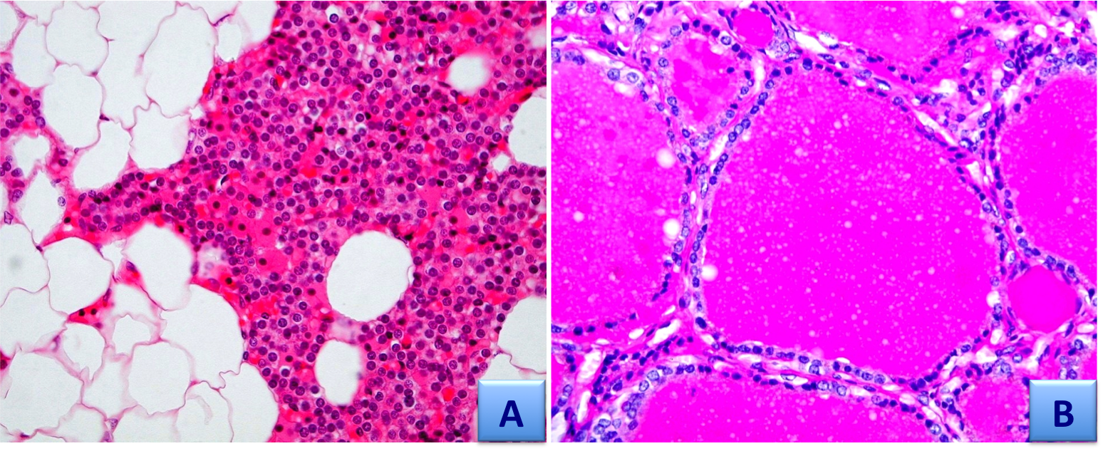 SOS BIOLOGIA CELULAR Y TISULAR: ENDOCRINO. TIROIDES / PARATIROIDES