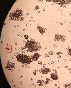 BENDA ERGASTIK ALEURON PADA TUMBUHAN