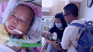 Apa Itu Patau Syndrome? Gejala, Penyebab Dan Cara Mengobatinya