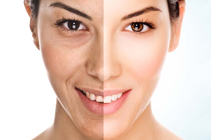 MEDICAL MIRACLES : 21 Natural Ways To Reduce Wrinkles On Your Skin