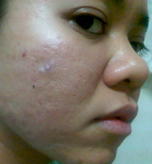 the road to hell is littered with good intentions: Skin