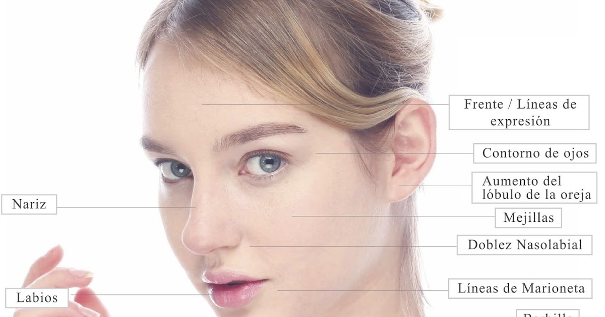 Botox, Acido Hialurónico, Bichectomia, Invisible Touch Hilos Pdo