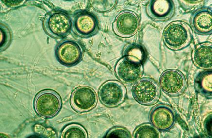 Lecture Notes in Medical Technology: Lecture #16: INTRODUCTION TO MYCOLOGY