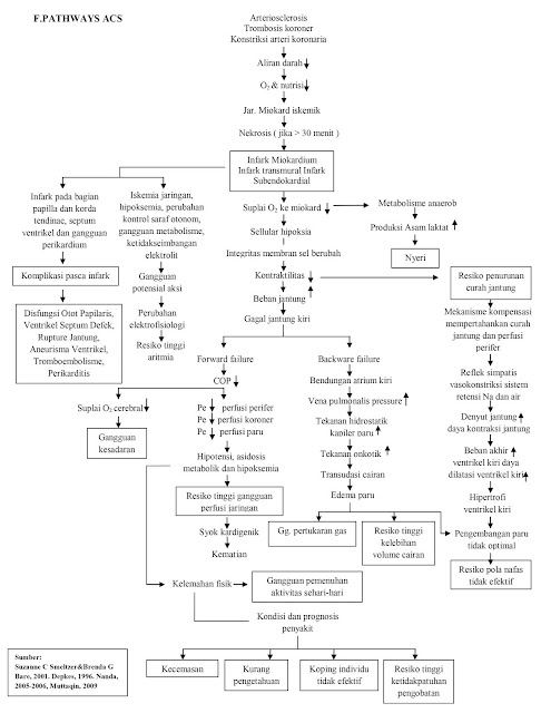 PATHWAYS ACS - Arteriosclerosis, Trombosis koroner, Konstriksi arteri ...