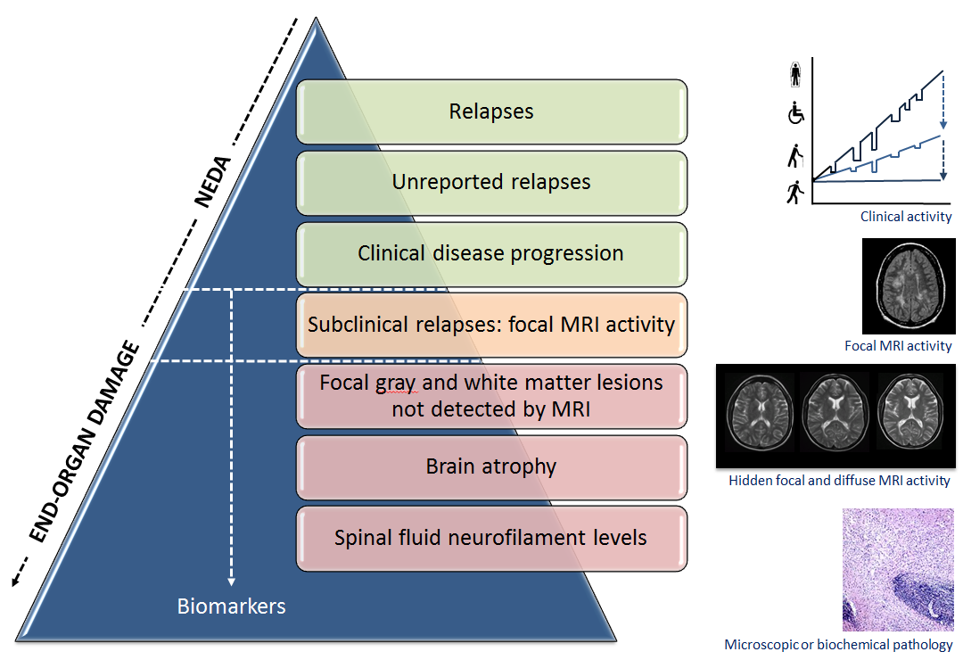Multiple Sclerosis Research: ClinicSpeak: smouldering MS