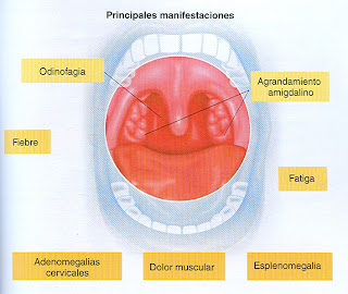 Microbiología médica: Diagnostico de la faringitis por Streptococcus ...