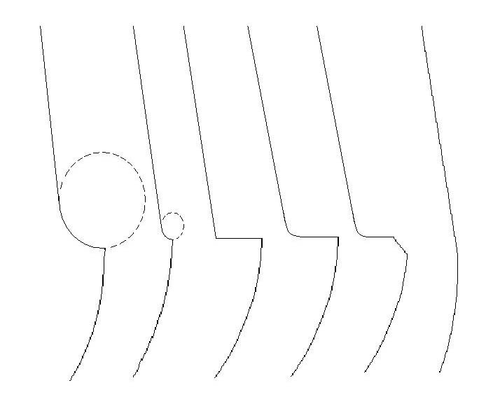 Muito bom esse café !: Principios do preparo dos dentes ( Prótese Fixa I )