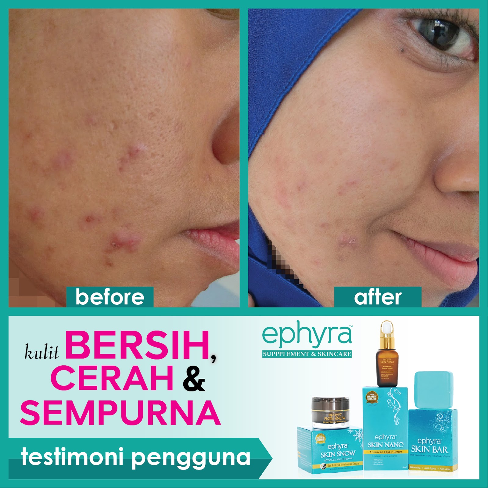 EPHYRA SKIN SNOW | BEAUTY KIOSK