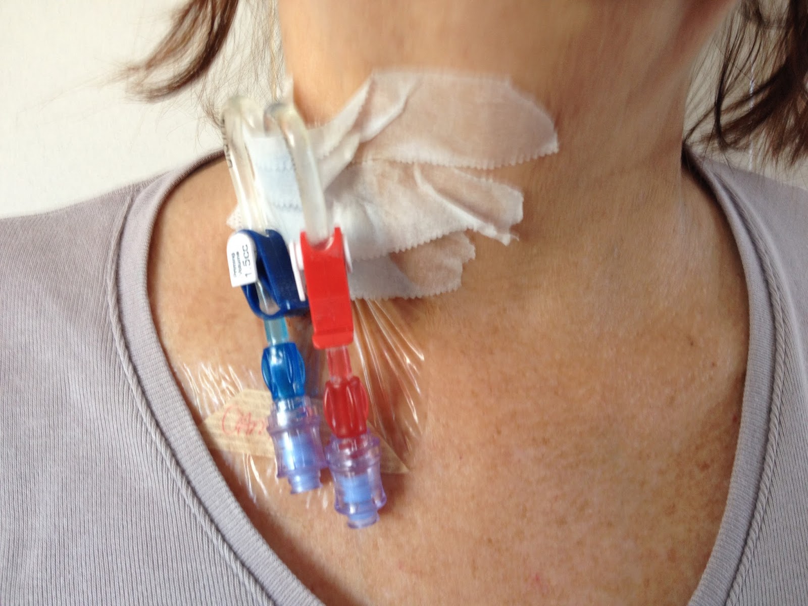 Minha experiência na hemodiálise