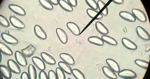 Tecnica de Graham- deteccion de oxiuros