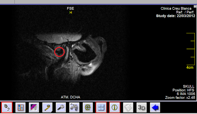 Dentistry: Magnetic resonance imaging of TMJ
