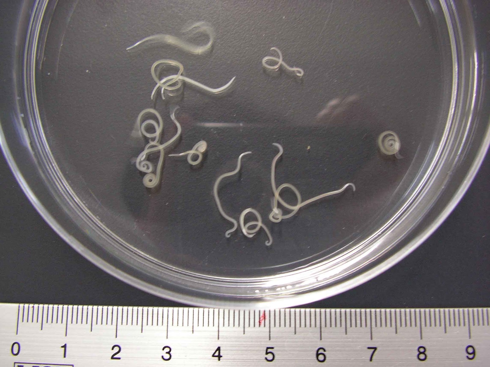 Verminoses: Anisakíase (RARA NO BRASIL)
