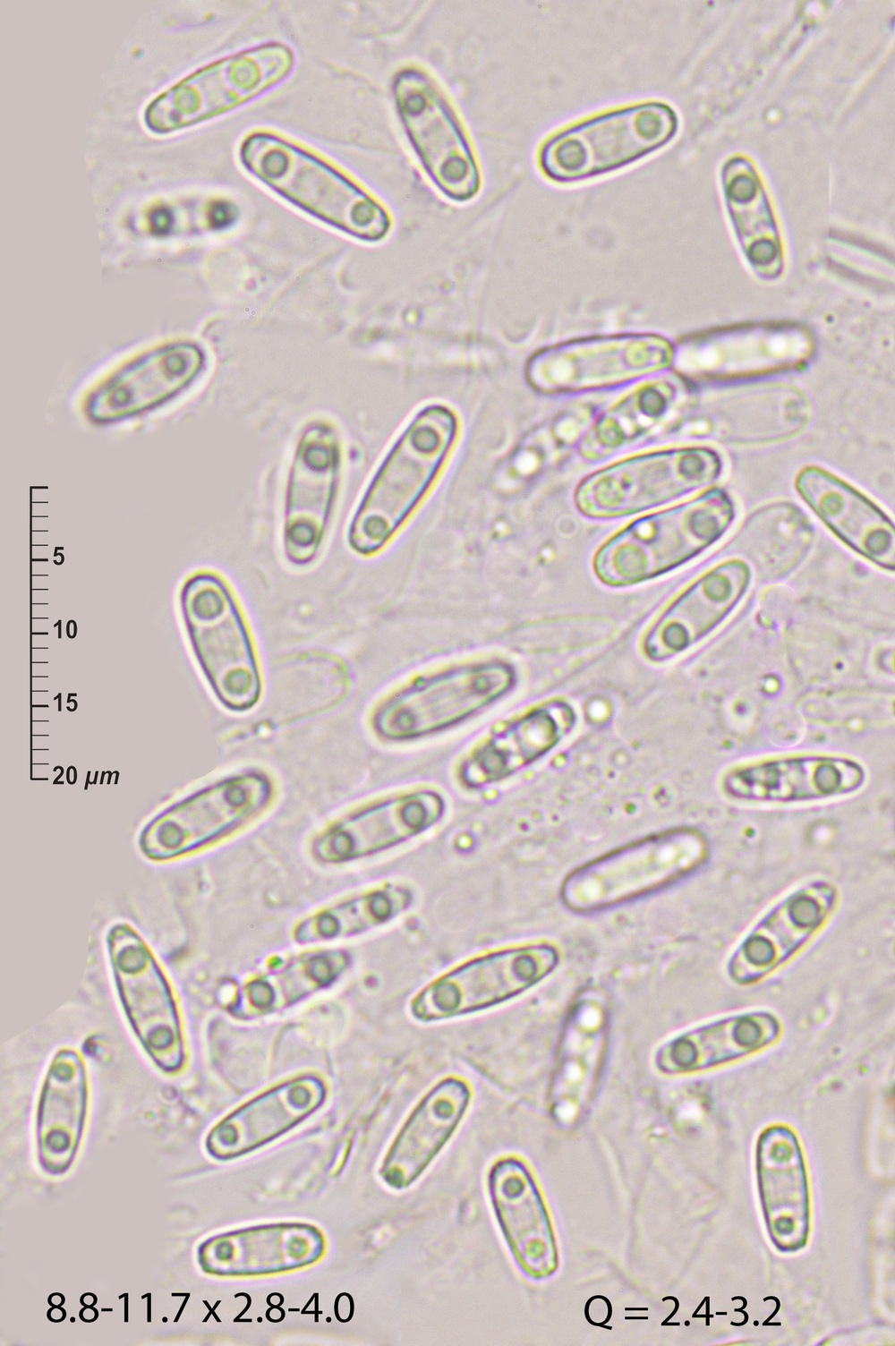 Phomatospora sp. ERD-7535 • CEMAS