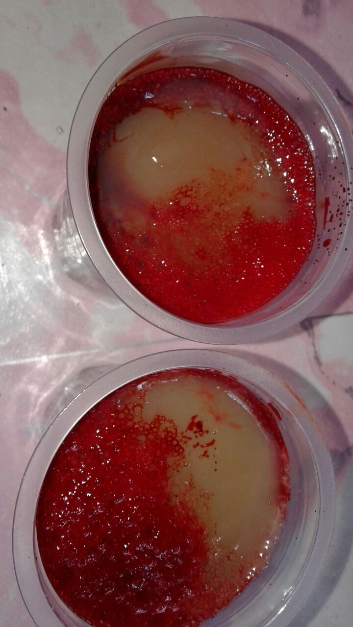 TERAPI FASHDU DI BANDUNG: 2017