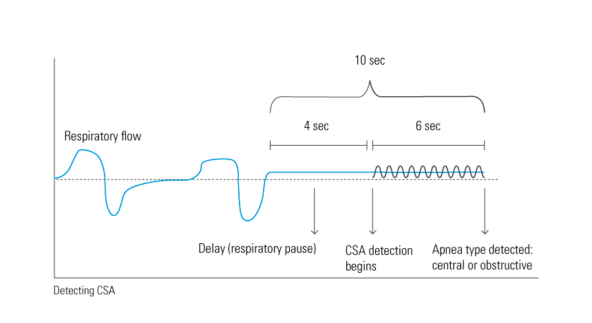 Jak działa algorytm w urządzeniu CPAP (APAP)? - CPAP blog - leczenie ...