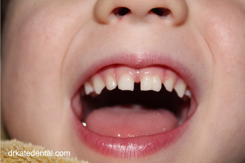 DRKATEDENTAL.COM: One Very Big Tooth?