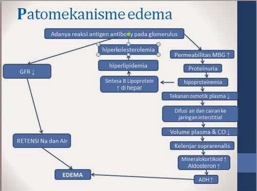 Medicolicious: Patomekanisme edema