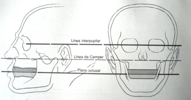 Prostodoncia total: Definición y conceptos de Prostodoncia Total