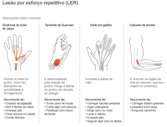 BR Physio: LER - LESÃO POR ESFORÇO REPETITIVO
