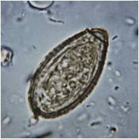Clonorchis Sinensis ~ Examination and Happiness