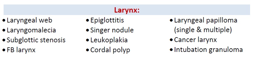 Laryngeal web