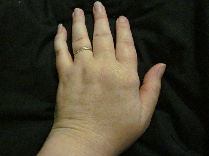 Rheumatoid Arthritis Society Cimzia