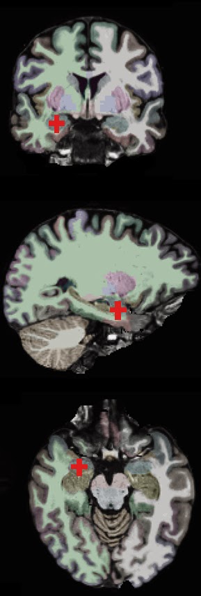 Il Credino: La Sacra Sindrome: L'Anatomia Del Credino
