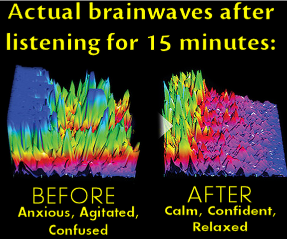Music Therapy | This Creative Practice can Protect and Boost Brain ...