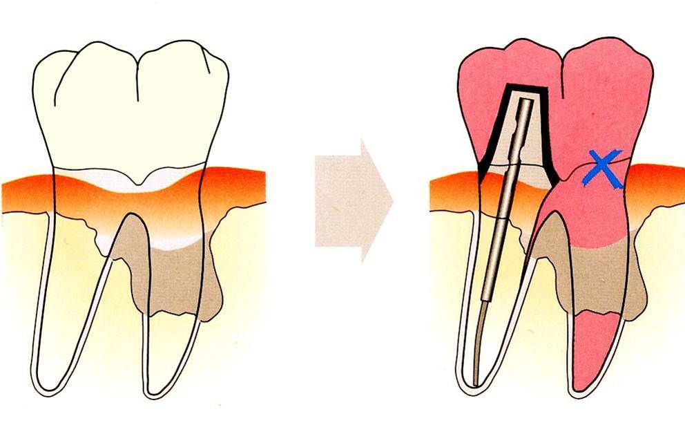 PerioClinic - Periodontia Especializada e Implantodontia: Tratamento ...