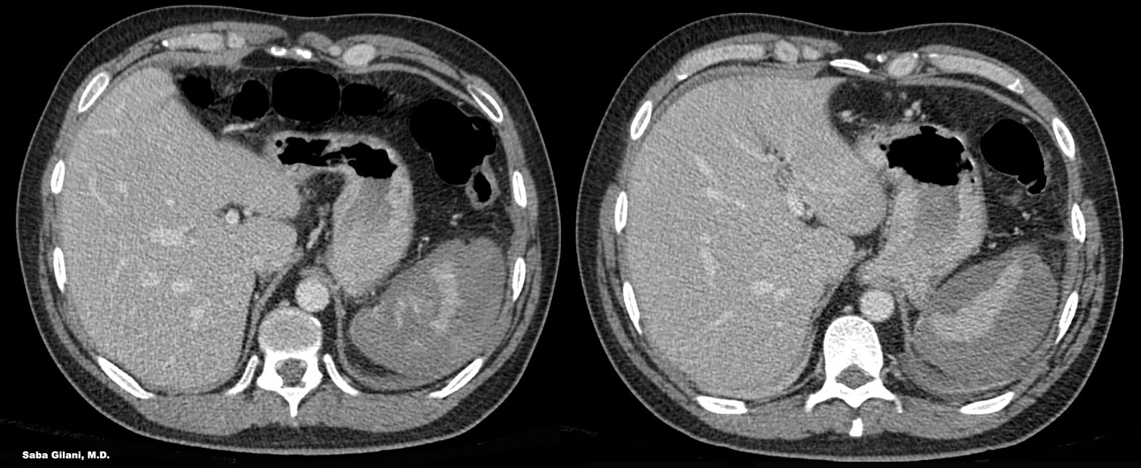 Roentgen Ray Reader: October 2012