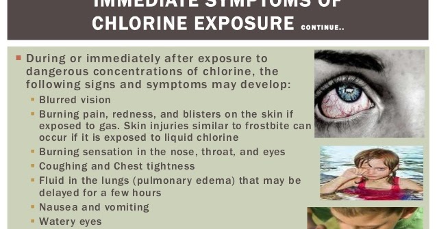 Chlorine gas poisoning ကလိုရင္းဓါတ္ေငြ႔အဆိပ္
