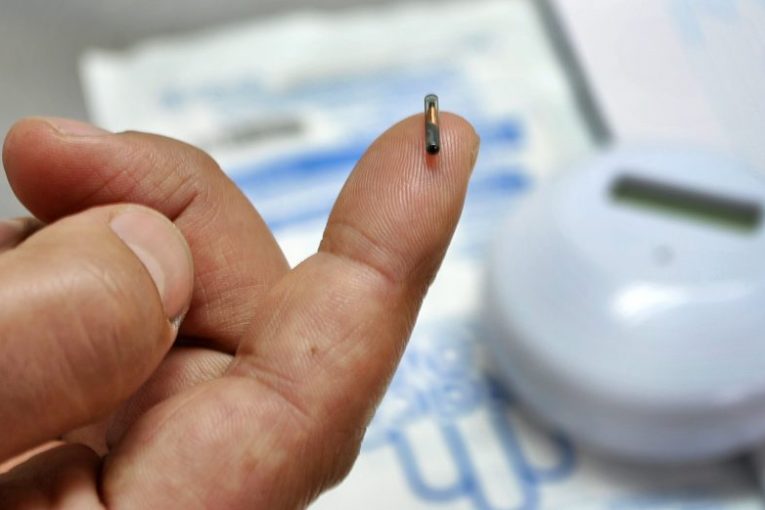 Chip Subcutáneo para humanos: una nueva forma de monitorear la salud