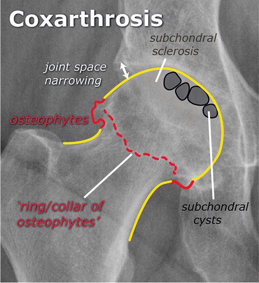 CamRadTech: Hip X ray