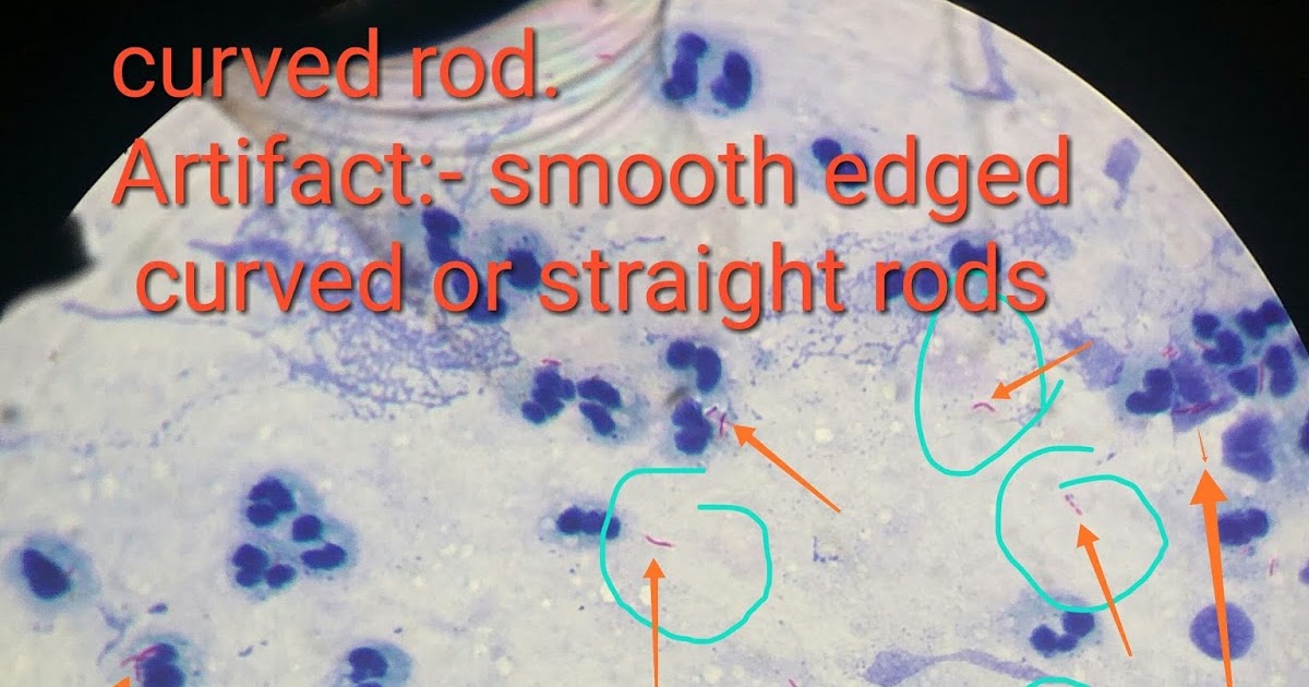 Z-N staining method (AFB stain) -- part-1