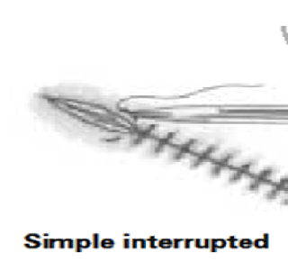 human body muscles: SUTURE MATERIALS AND SUTURING TECHNIQUE