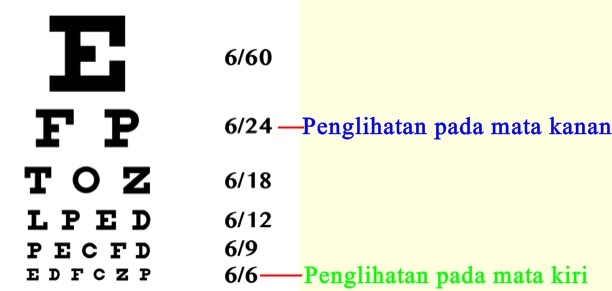 My OpToMeTRy JouRNey: KanTa SeNtuH UntuK Si MAta BeRLaiNan KuaSa....