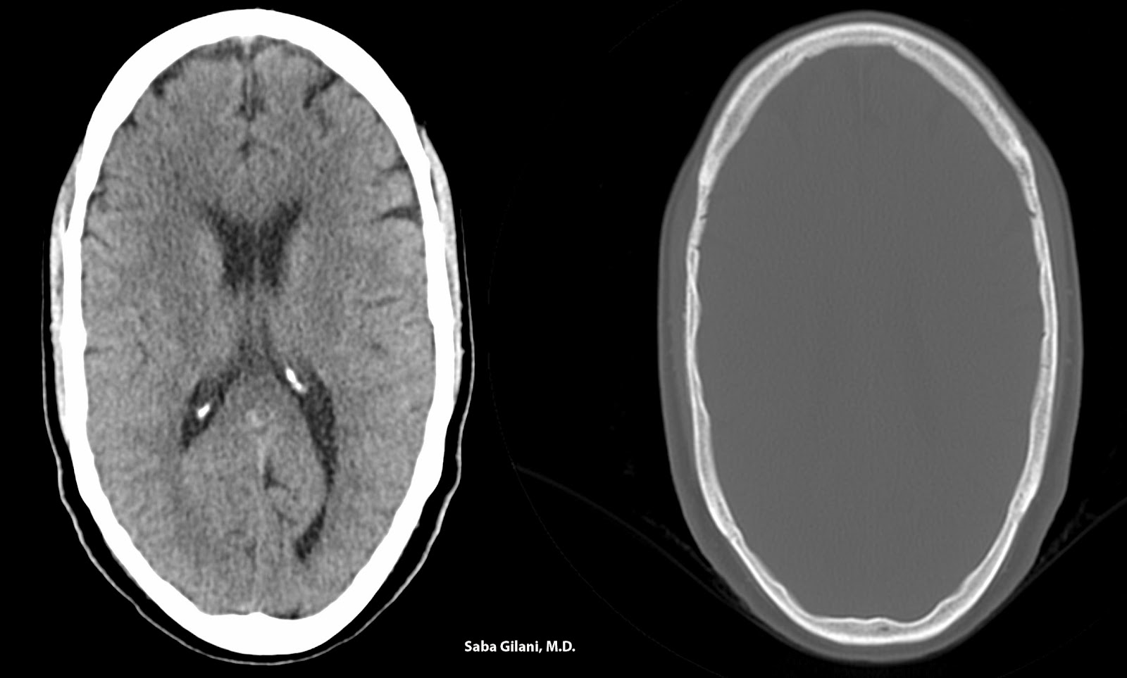 Roentgen Ray Reader: August 2012