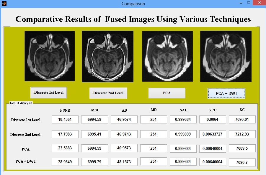 Image Fusion On MRI And CT Image Using Wavelet Transform Full Matlab Project Code || IEEE Based ...
