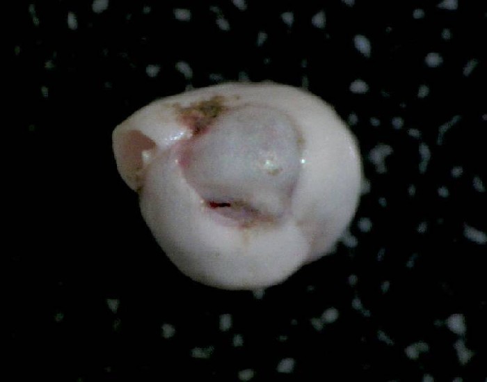 Variety of Life: Miliolinellinae