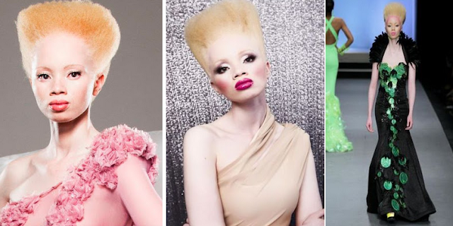EBAL's Blog: South African model Thando Hopa revels in her albino skin